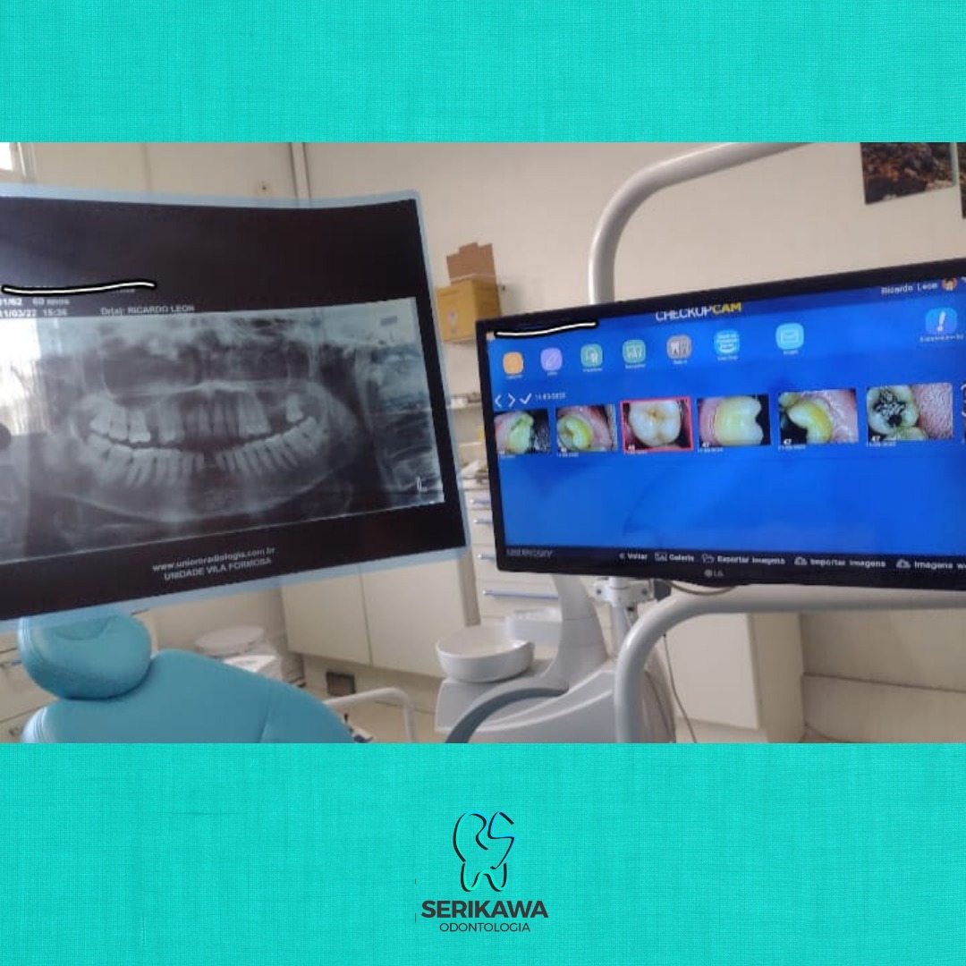 Serikawa Odontologia – Dr Ricardo Leon – CROSP 79820